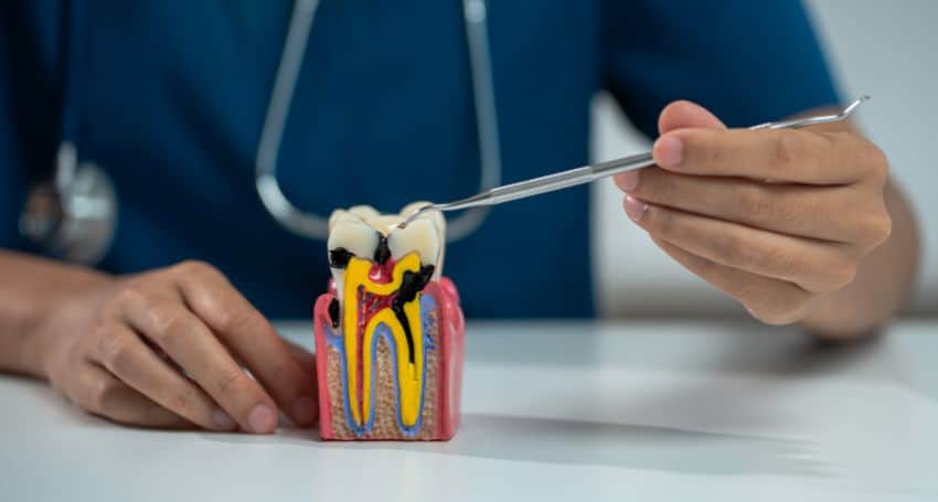 Root Canal Symptoms : Key Warning Signs You Shouldn’t Ignore